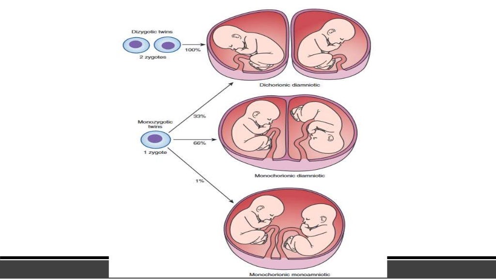 Multifetal pregnancy RADIOLOGY