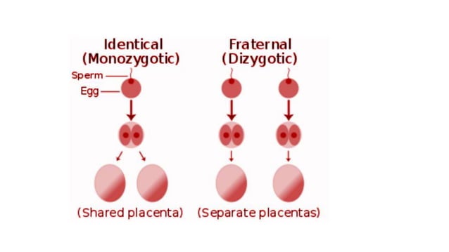 Multifetal Pregnancy.pptx