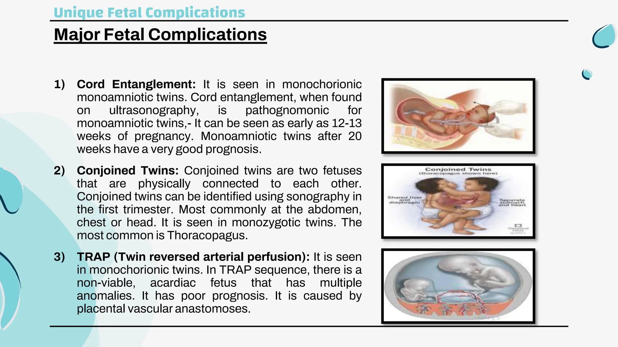 Complications of Multiple Pregnancy .pptx