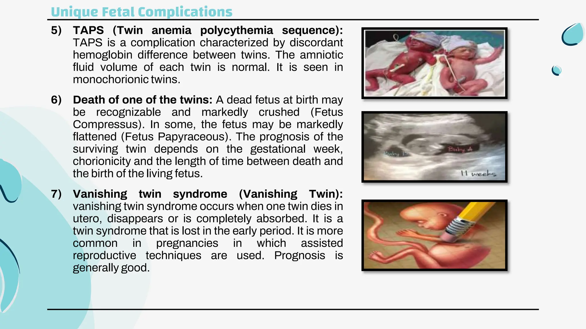 Complications of Multiple Pregnancy .pptx