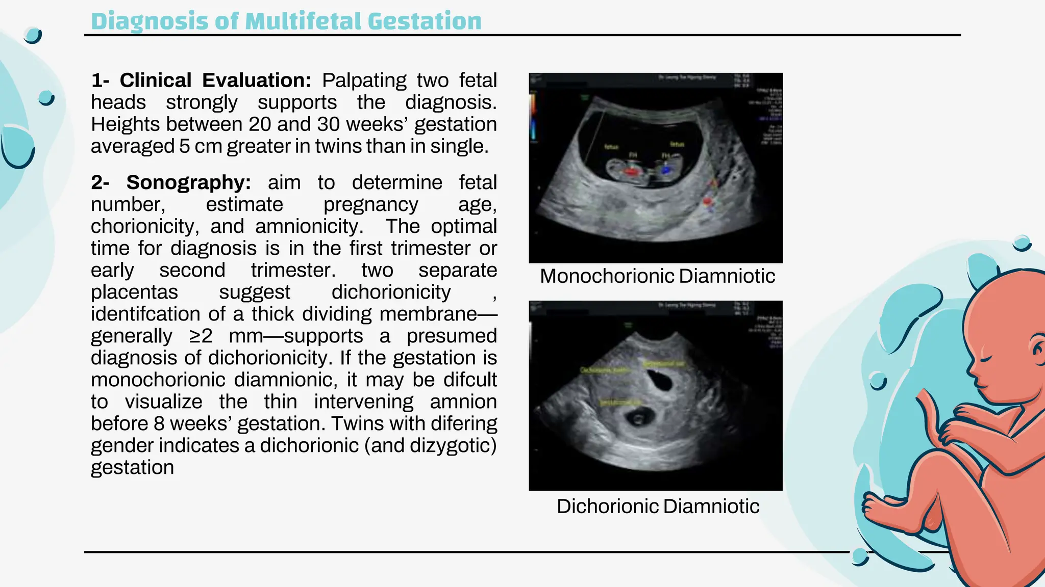 Complications of Multiple Pregnancy .pptx