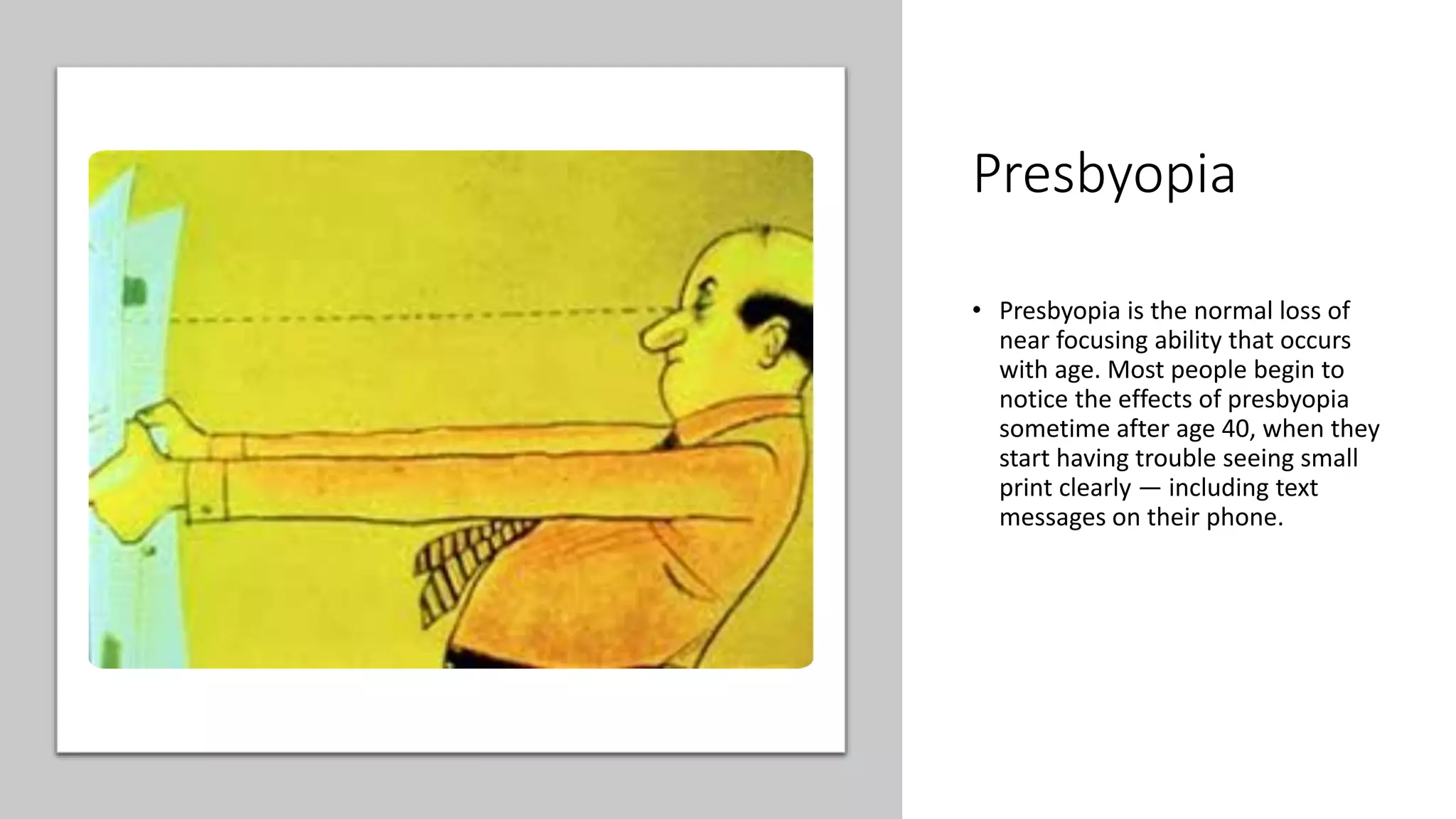 Multifocal cl fitting meenakshi | PPTX