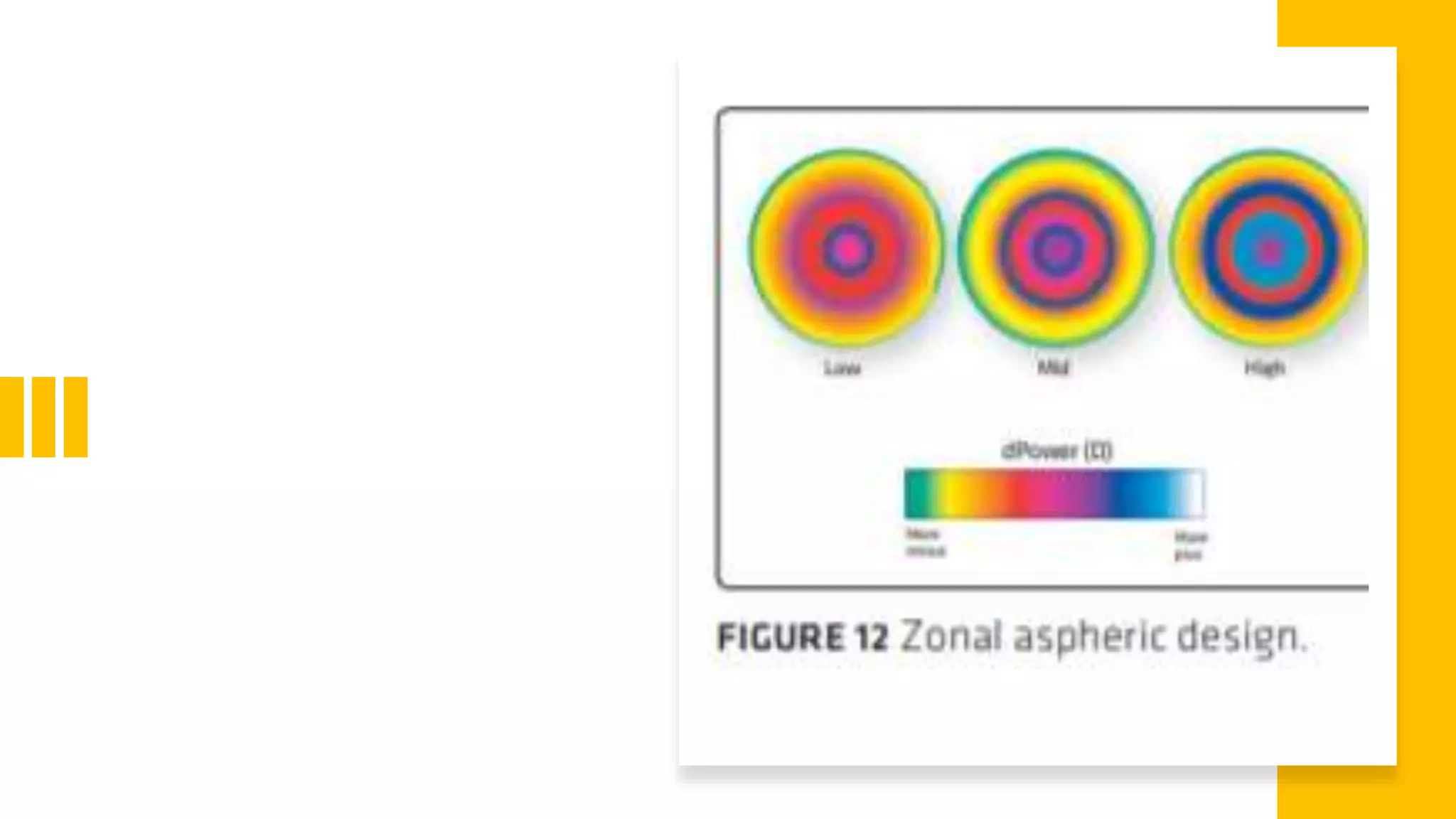 Multifocal cl fitting meenakshi | PPTX