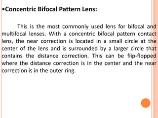 Multifocal contact lens | PPTX