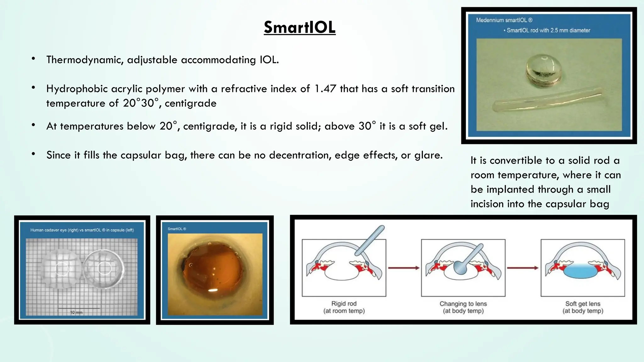 Let's learn everything about MULTIFOCAL IOL .pptx