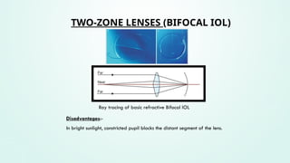 Let's learn everything about MULTIFOCAL IOL .pptx