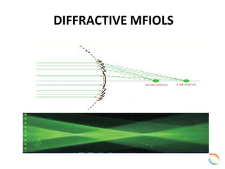 Multifocal IOL | PPTX
