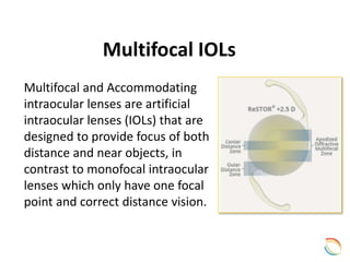 Multifocal IOL | PPTX