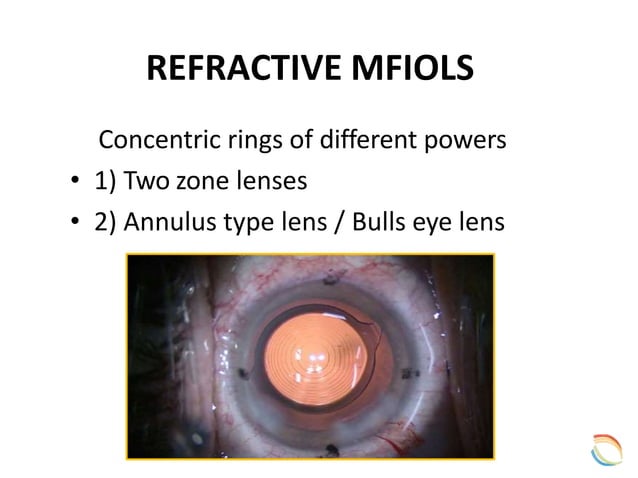Multifocal IOL | PPTX