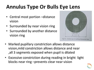 Multifocal IOL | PPTX