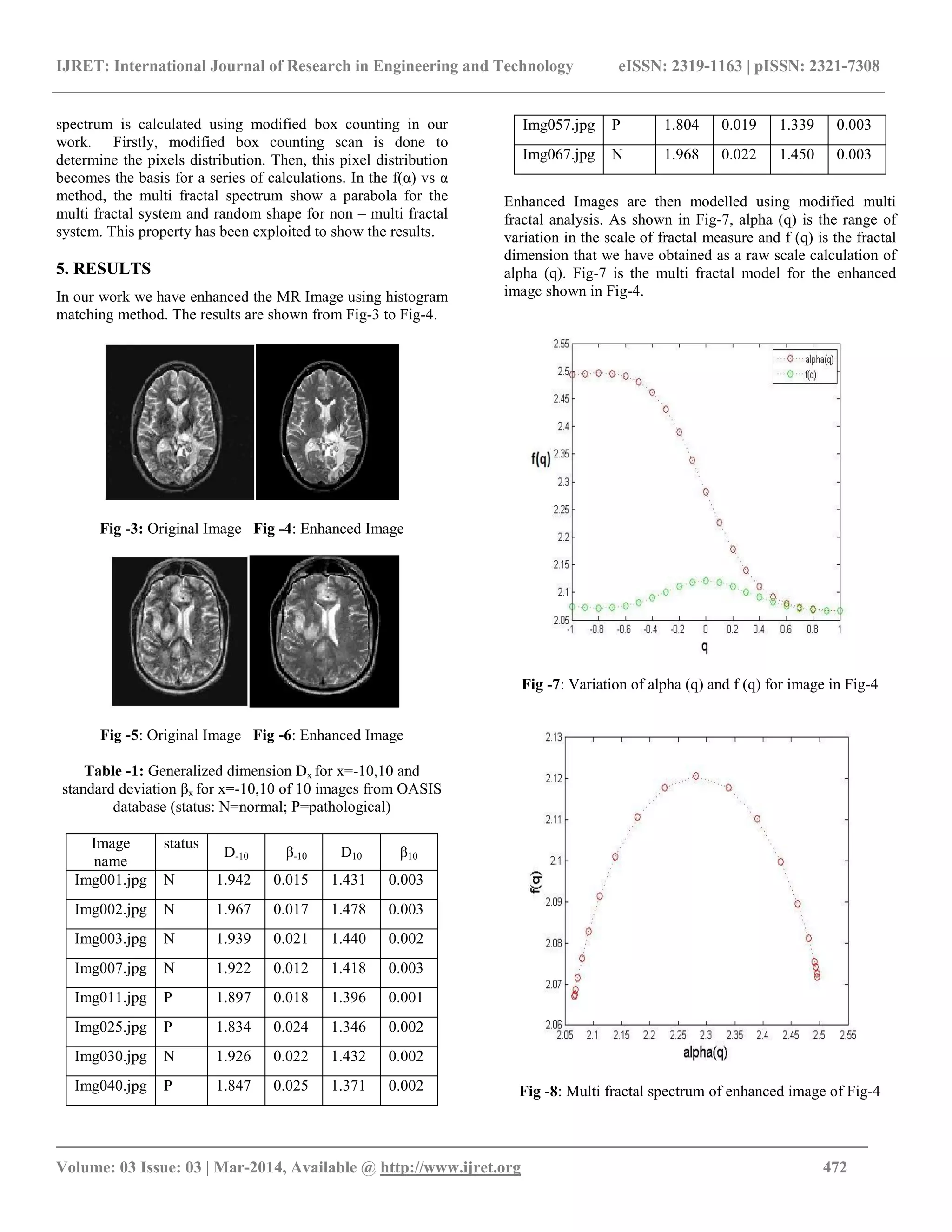 Multi fractal analysis of human brain mr image | PDF