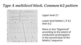 Multilevel AV block: benign and malignant | PPTX