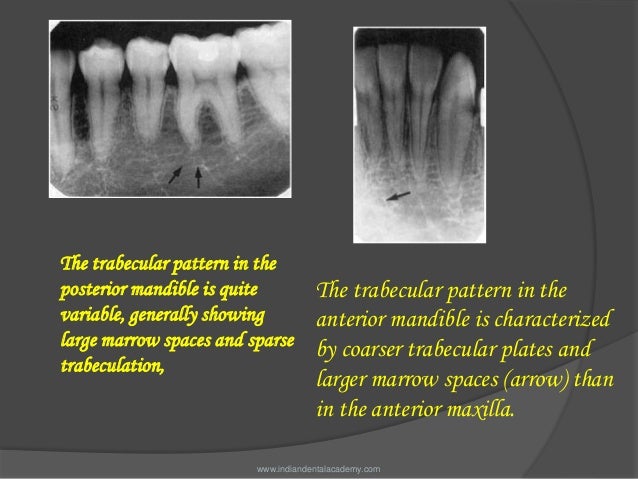 Multilocular radiolucencies /endodontic courses
