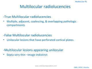 Multilocular radiolucencies/ oral surgery courses | PPT
