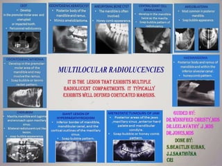 Multilocular radiolucencies modified1 | PPTX | Genetics | Science
