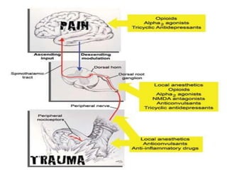 Multimodal analgesia Al Razi hospital Kuwait | PDF