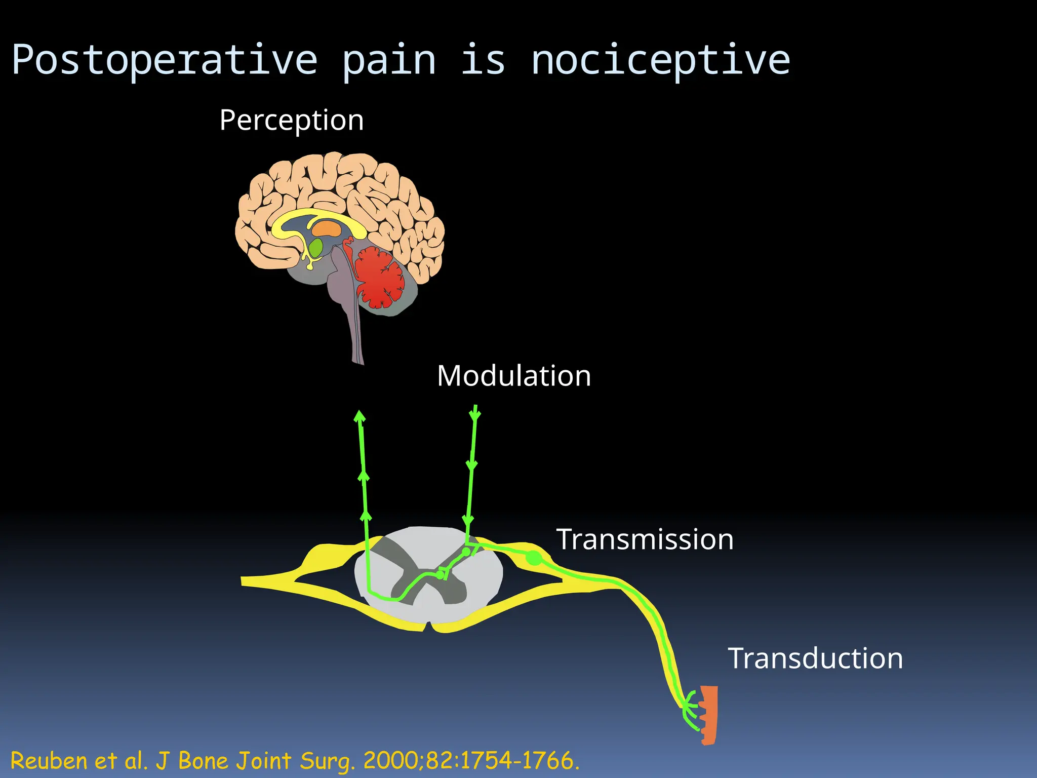 Multimodal approach in acute post operative pain.pptx