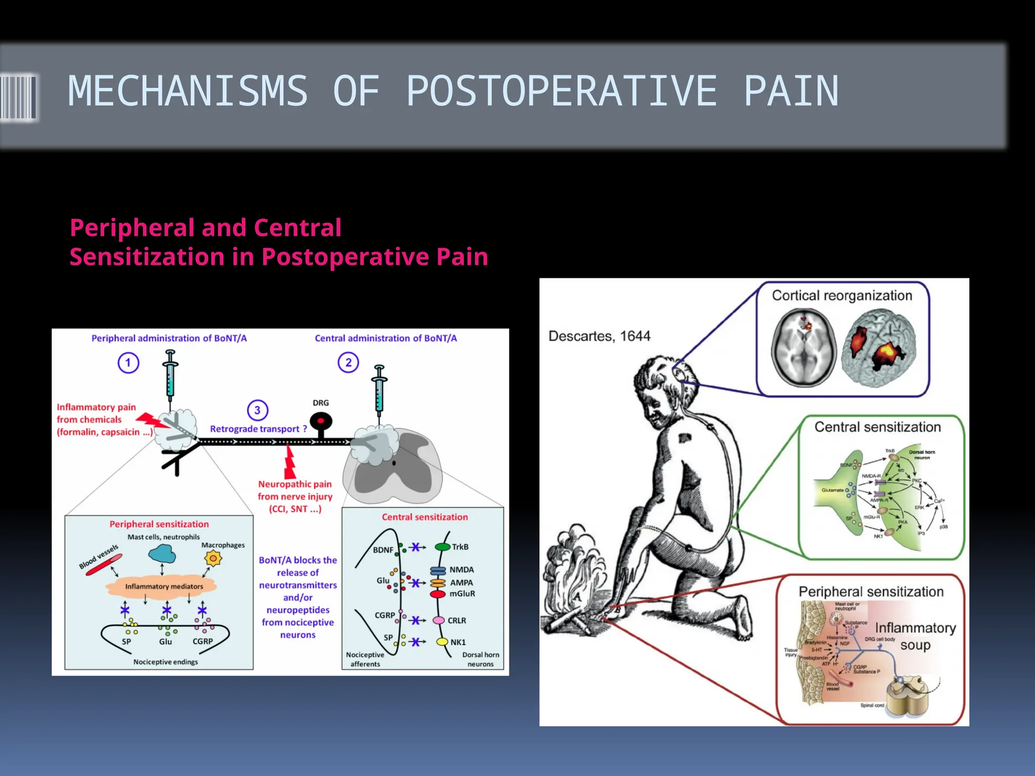 Multimodal approach in acute post operative pain.pptx