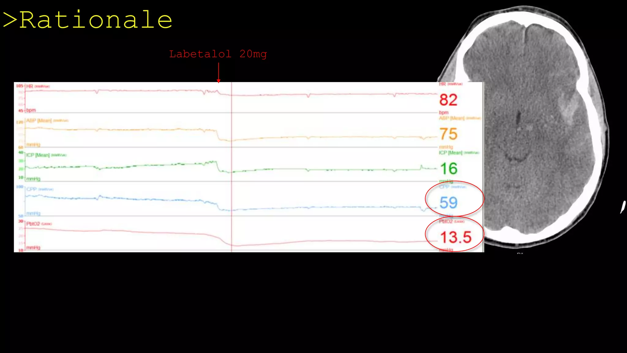 Multimodal monitoring | PPTX