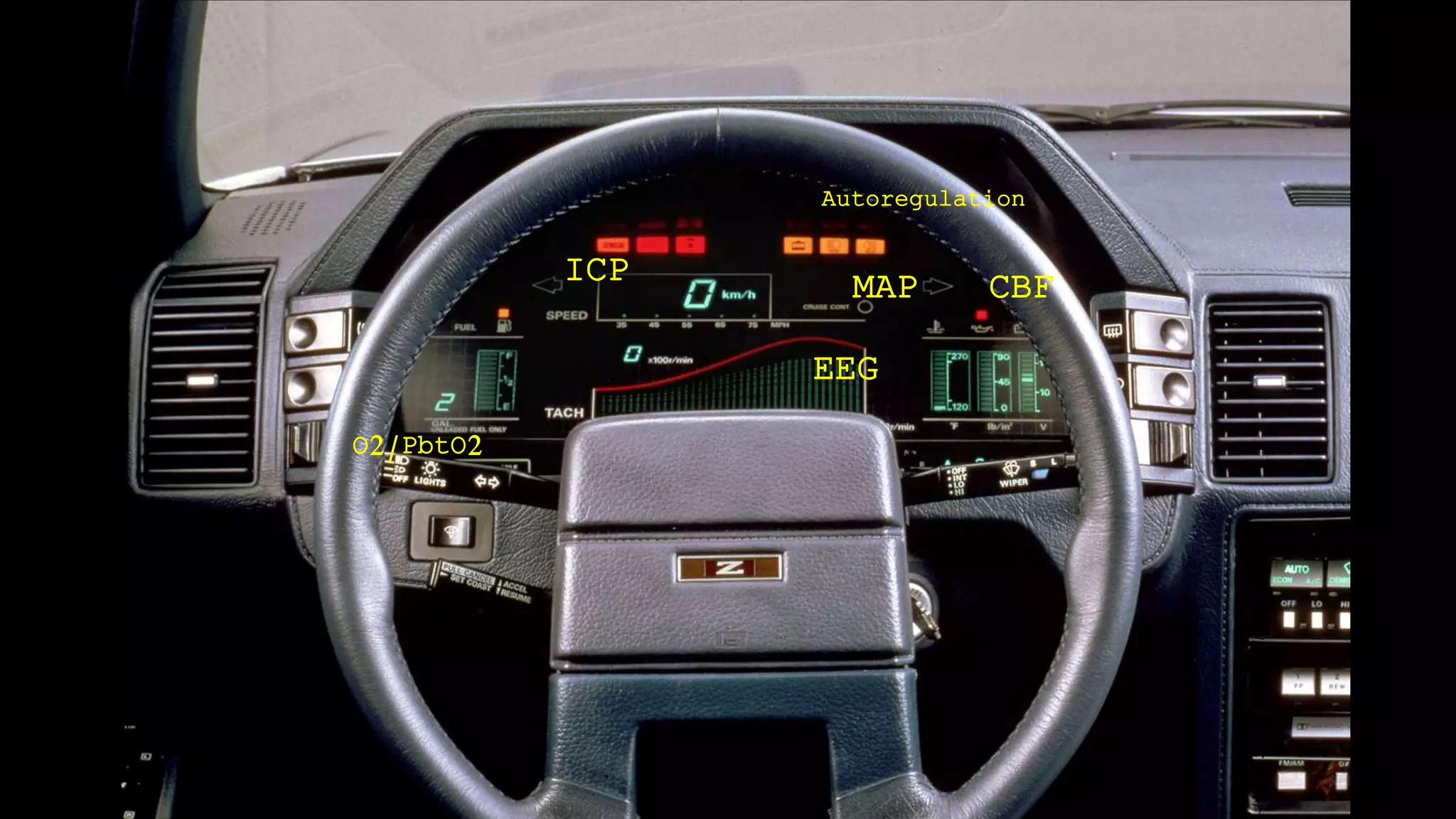 Multimodal monitoring | PPTX