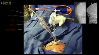 Multimodal monitoring | PPTX