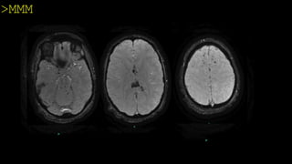 Multimodal monitoring | PPTX
