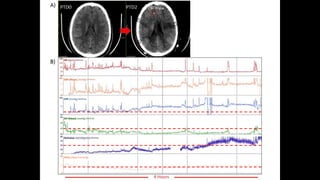 Multimodal monitoring | PPTX