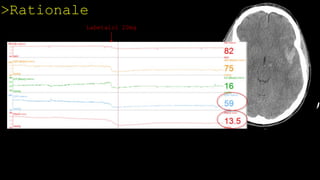 Multimodal monitoring | PPTX