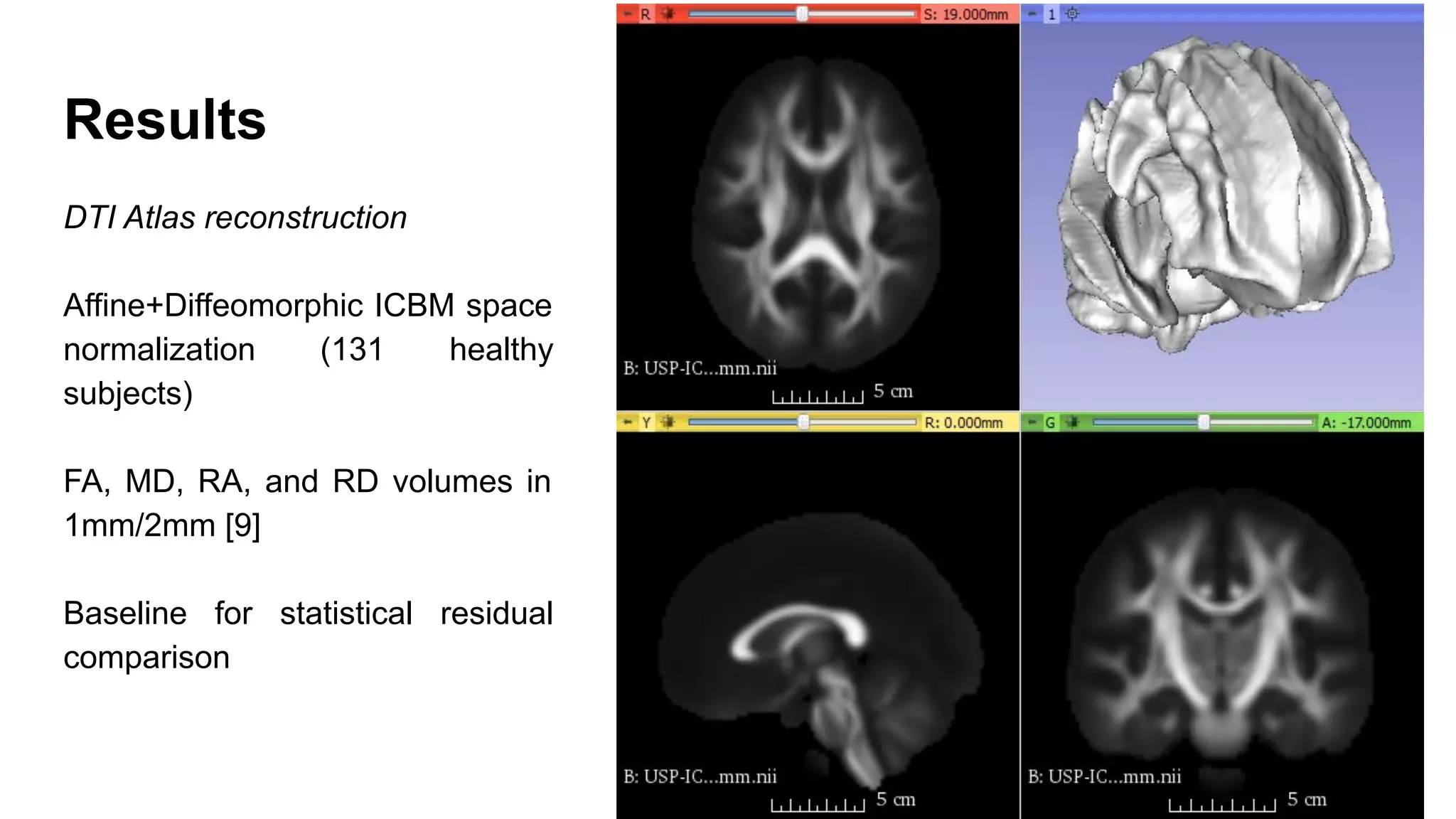 Multimodal MRI statistical segmentation of normal appearing white matter lesions in multiple ...