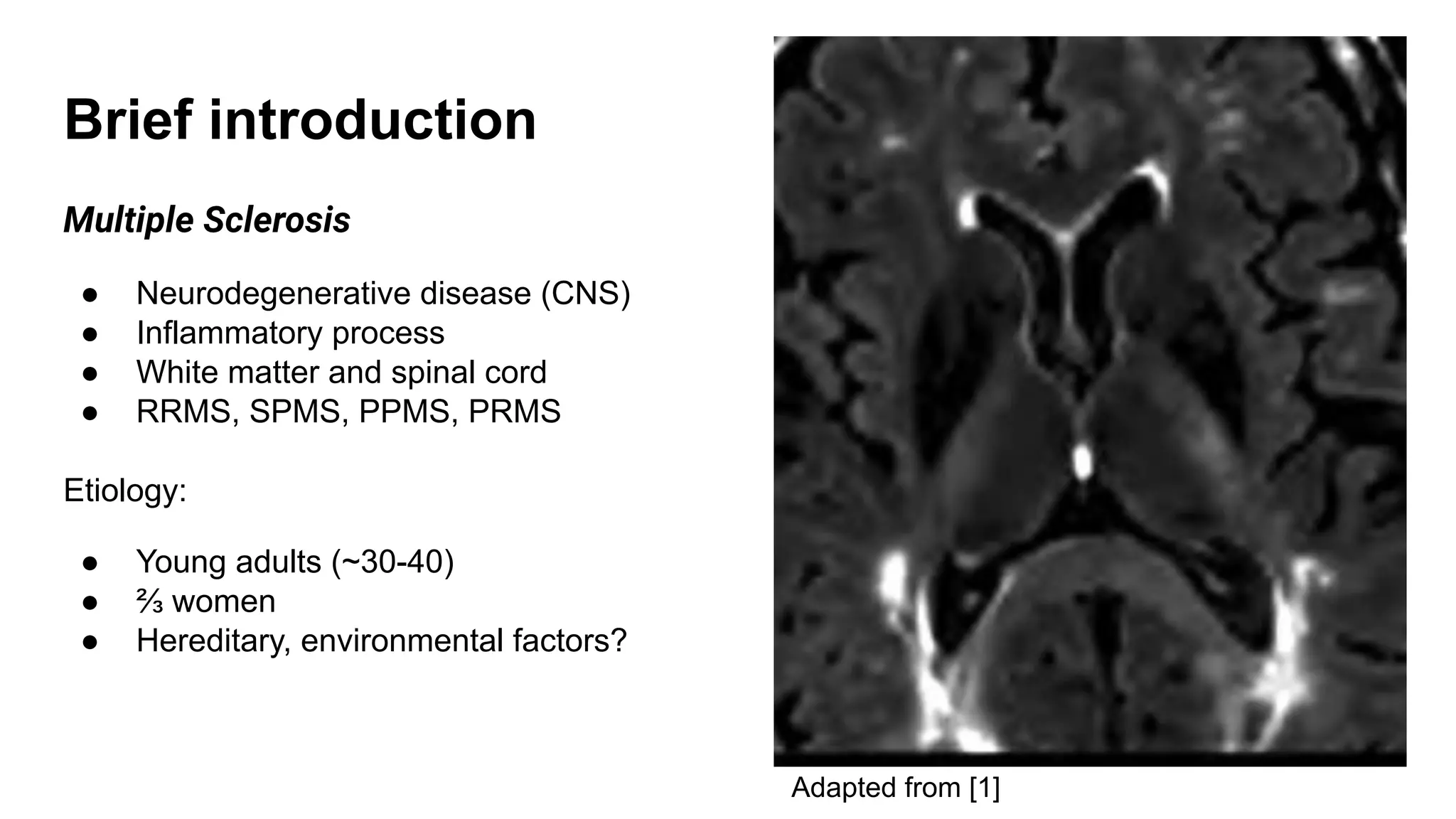 Multimodal MRI statistical segmentation of normal appearing white ...