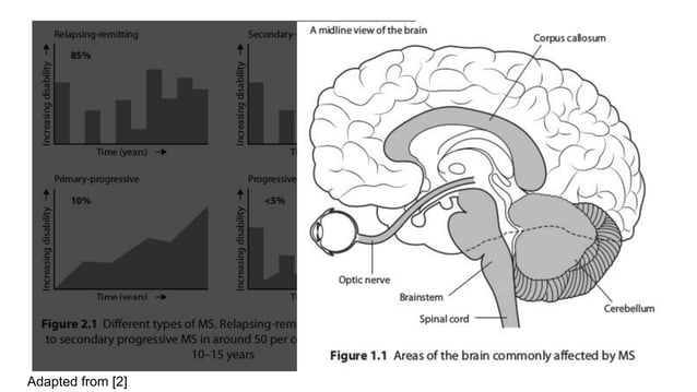 Multimodal MRI statistical segmentation of normal appearing white matter lesions in multiple ...