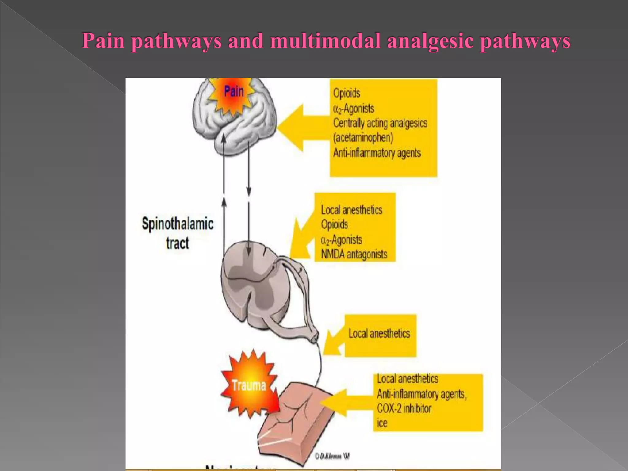 Multimodal pain management following surgical procedures | PPTX