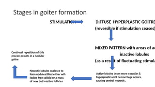 multinodular Goiter By Prasad Institute. | PPTX