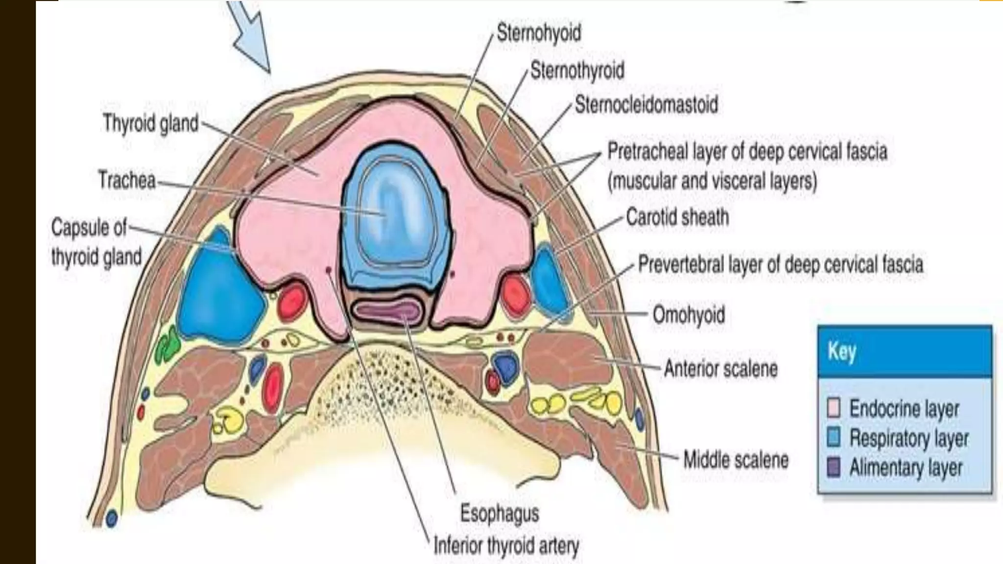 Multi nodular goitre (MNG) | PPTX