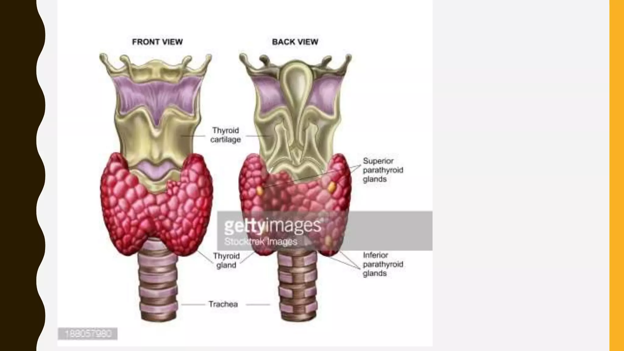 Multi nodular goitre (MNG) | PPTX