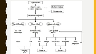 Multinodular Thyroid