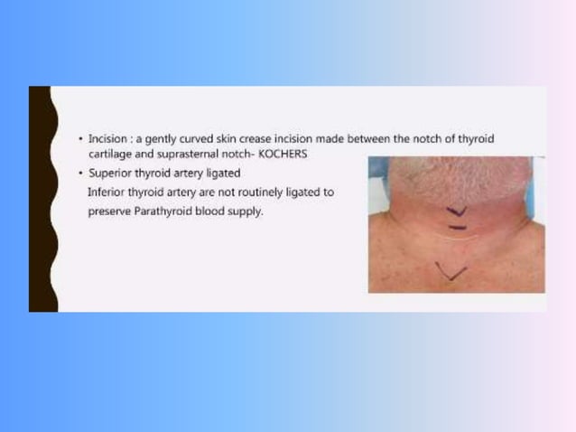 Multi Nodular Goitre MBBS 3rd year..pptx