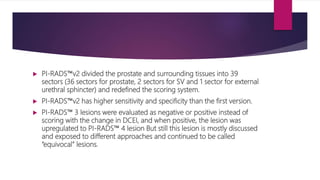 Multiparametric (mp) mri of prostate cancer | PPTX
