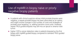 Multiparametric (mp) mri of prostate cancer | PPTX