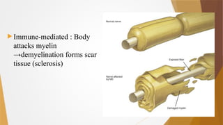 Multipe Sclerosis.pptx.................. | PPTX