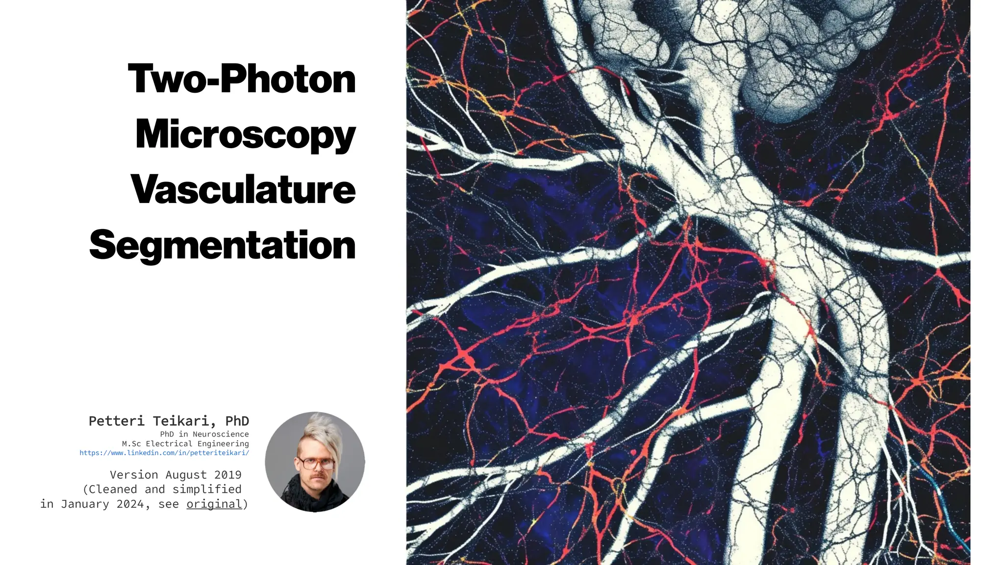 Two-Photon Microscopy Vasculature Segmentation | PDF | Technology & Computing