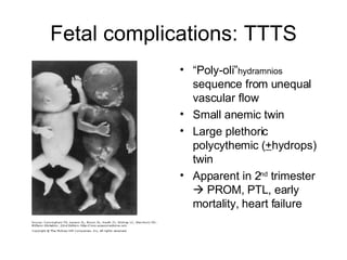 Multiple Gestations | PPT