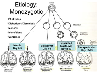 Multiple Gestations | PPT | Pregnancy | Reproductive Health