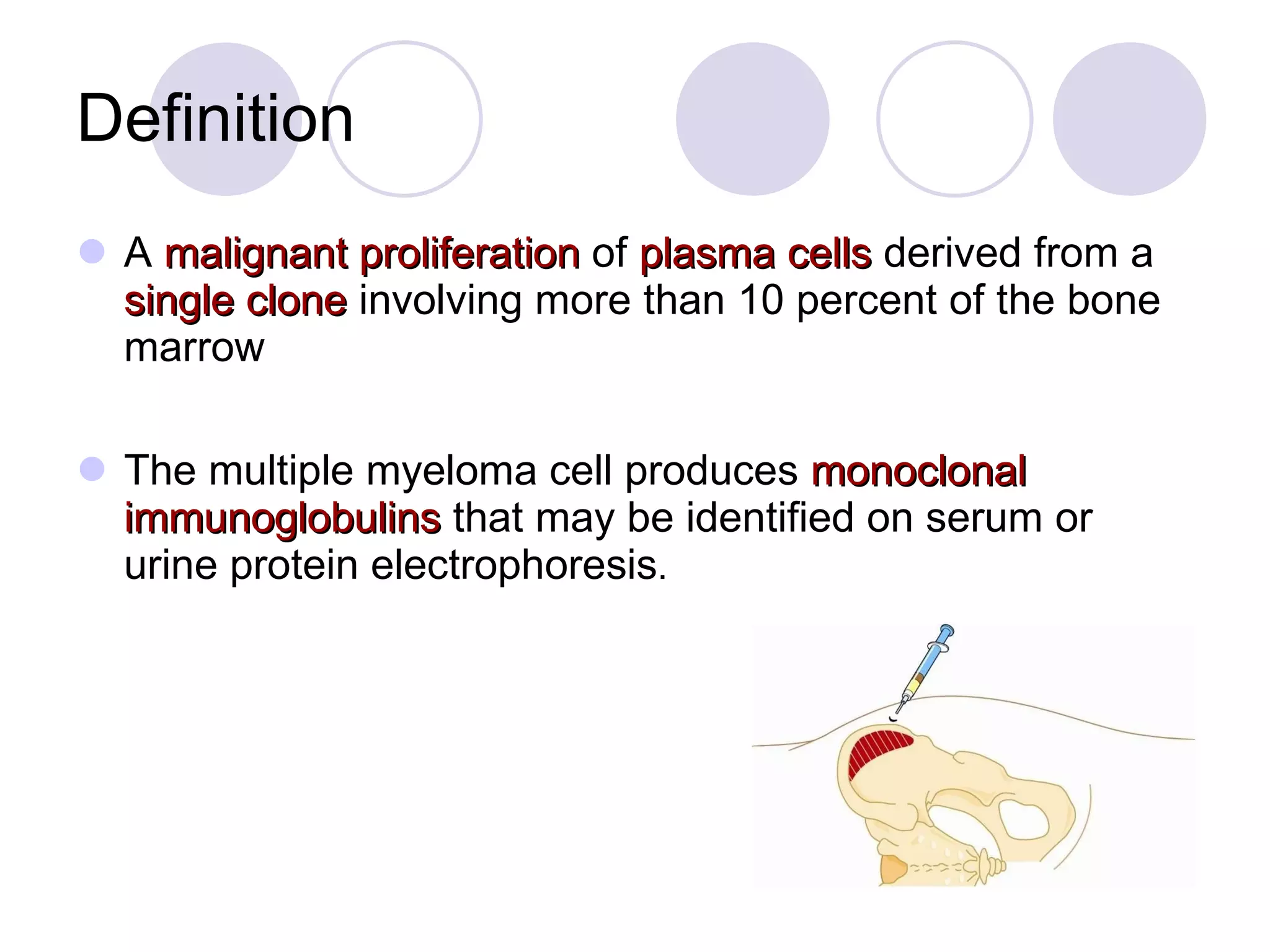 Multiple Myeloma Modified , Dr Gamal Abdul Hamid | PPT