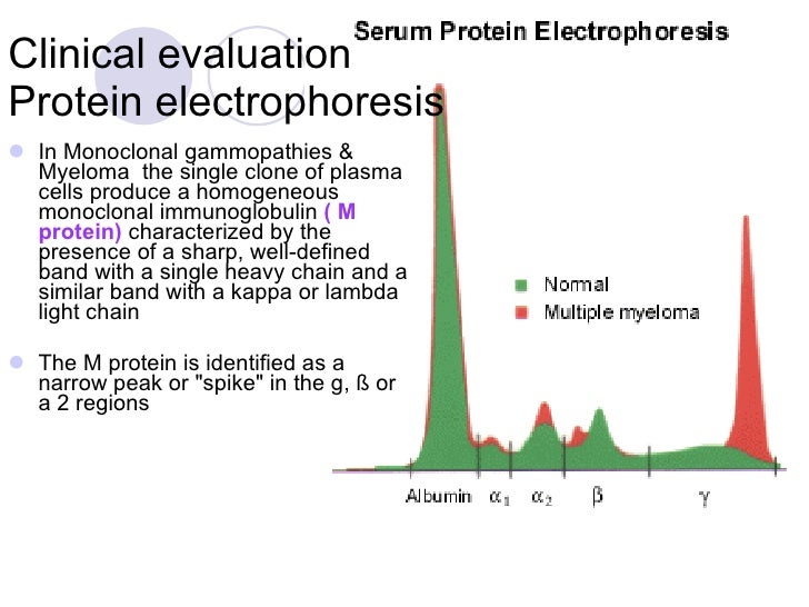 Protein Electrophoresis Serum Multiple Myeloma at Hae Wilson blog