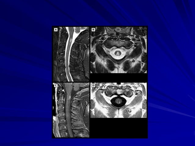 Multiple sclerosis-basic-principles-and-new-developments596 (1) | PPTX | Brain and Nervous ...