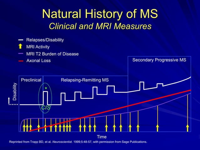 Multiple sclerosis-basic-principles-and-new-developments596 (1) | PPTX | Brain and Nervous ...