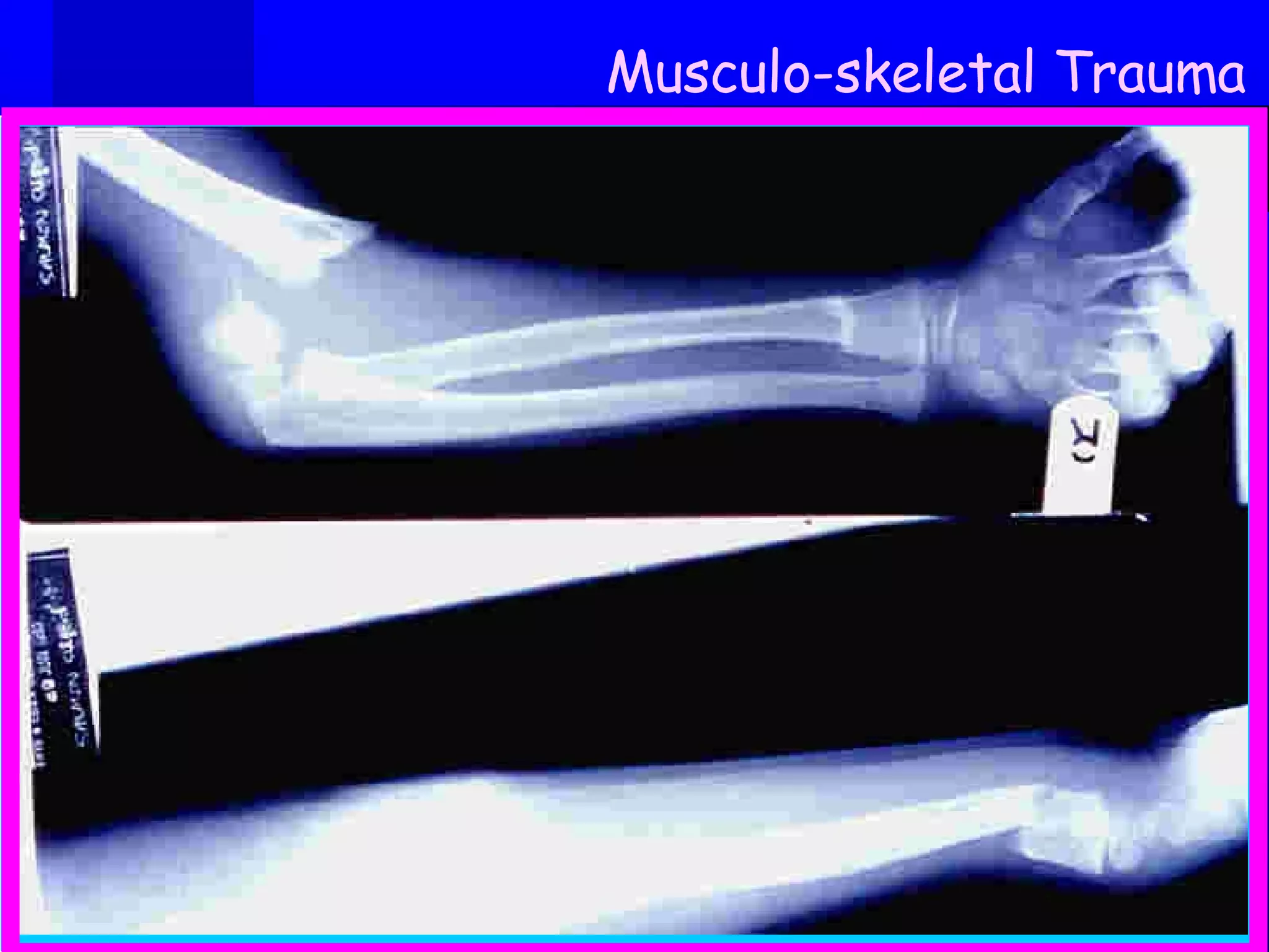 Multiple Trauma 1 | PPT