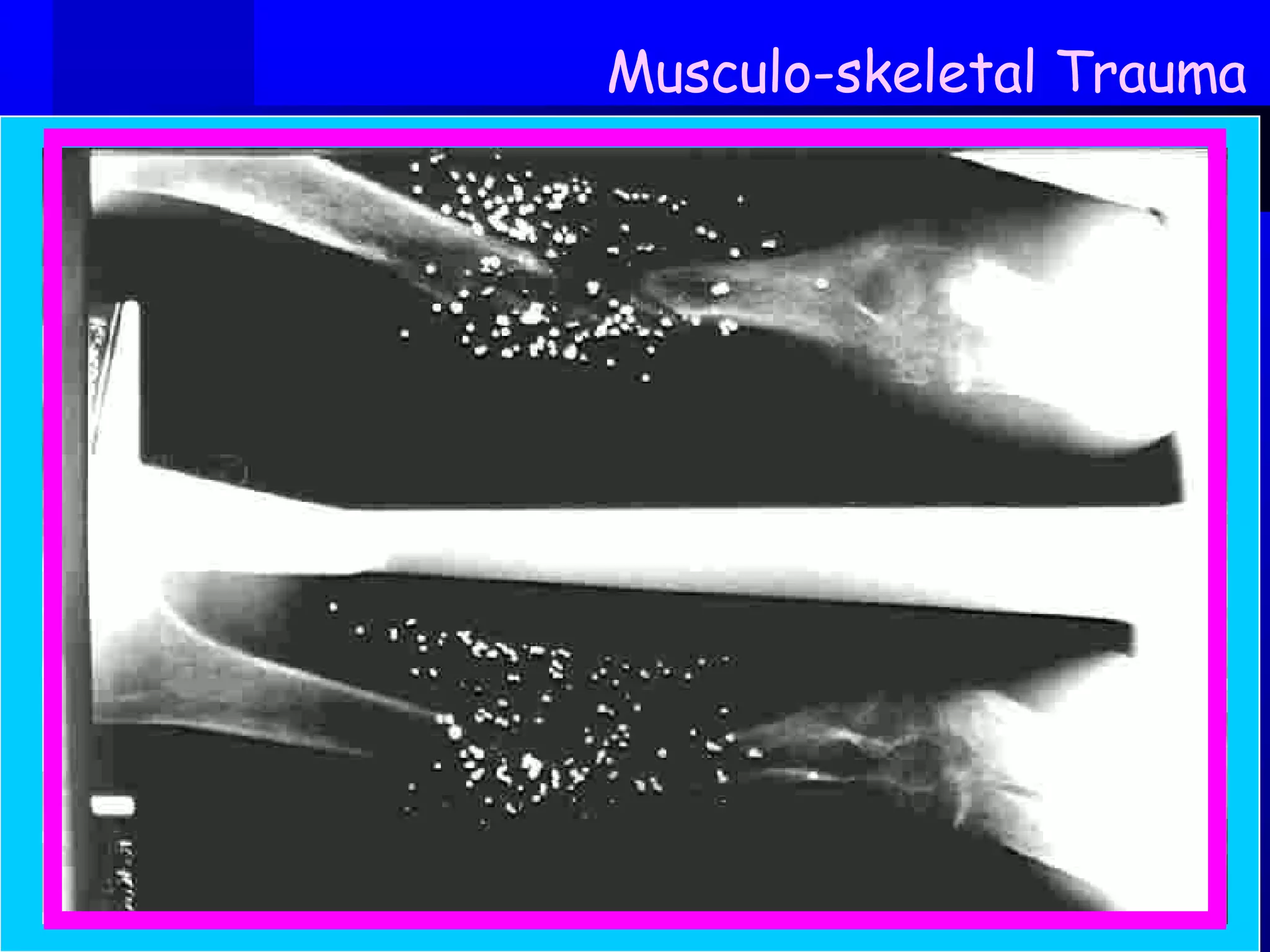 Multiple Trauma 1 | PPT