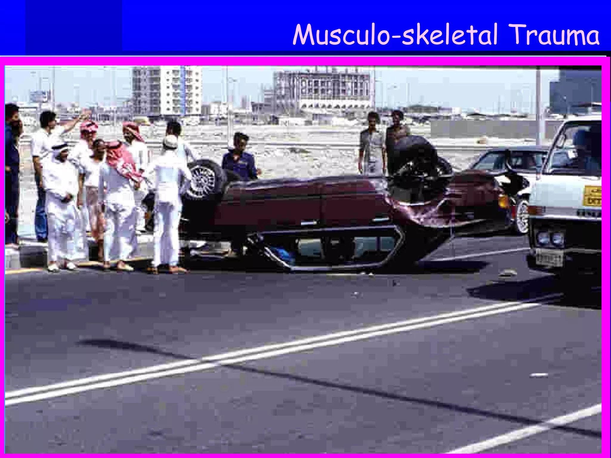 Multiple Trauma 1 | PPT